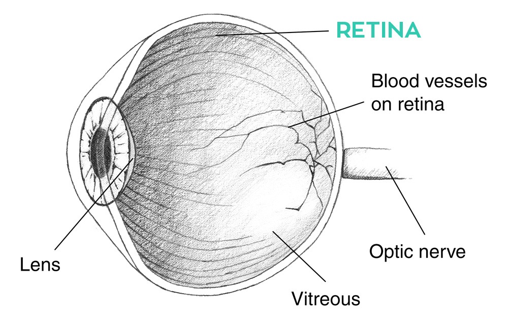 Sådan optimerer du til retina billeder - Engedal